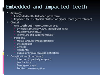 22.Disturbances of growth (Eruption) of teeth.ppt
