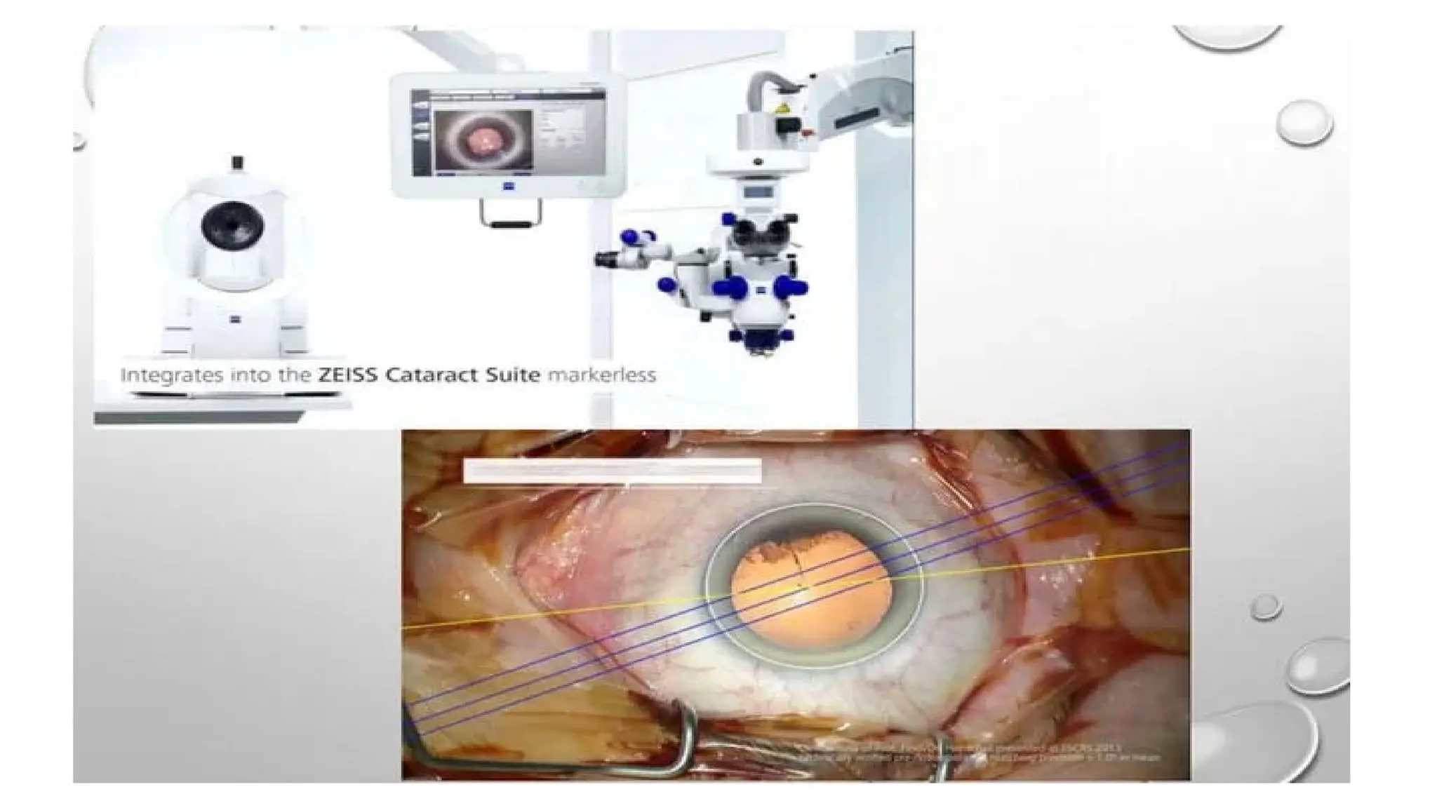 22. Biometry ophthalmology by Dr Rahul.pptx