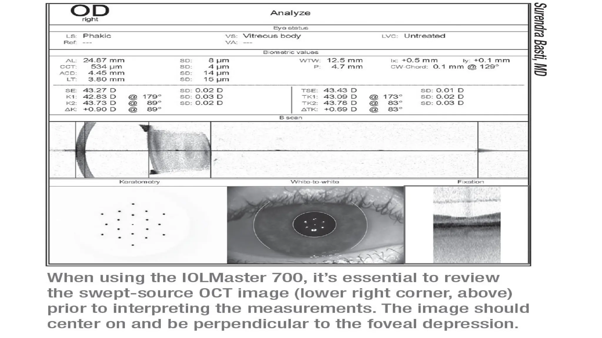 22. Biometry ophthalmology by Dr Rahul.pptx | Eye and Vision Conditions | Diseases and Conditions