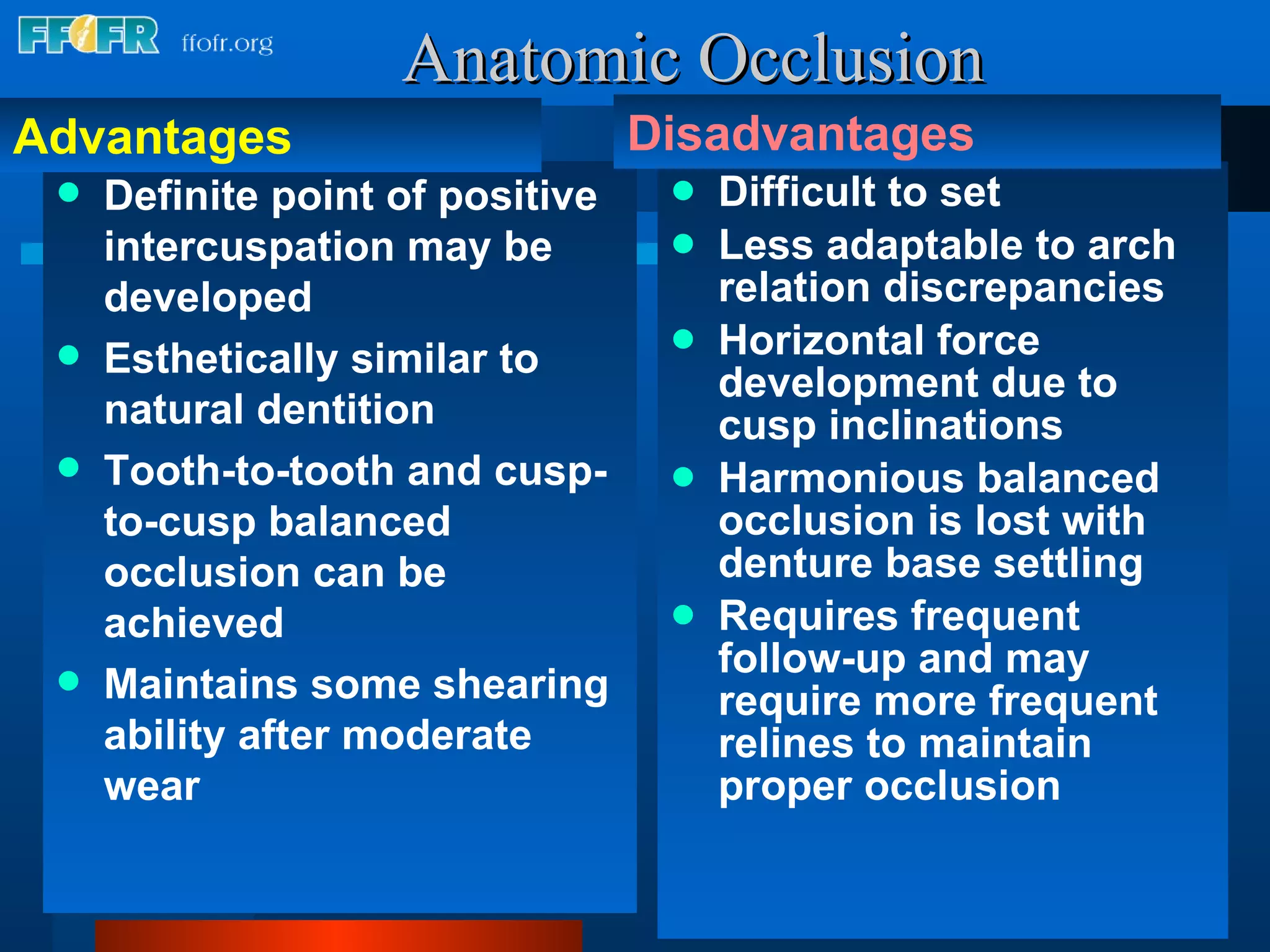 22.criteria for posterior tooth selection | PPT