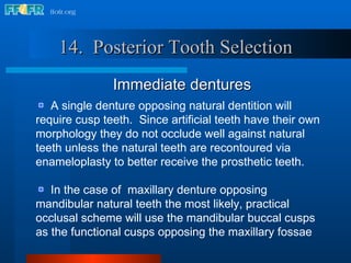 22.criteria for posterior tooth selection | PPT