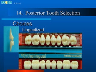 22.criteria for posterior tooth selection | PPT