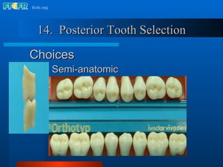 22.criteria for posterior tooth selection | PPT