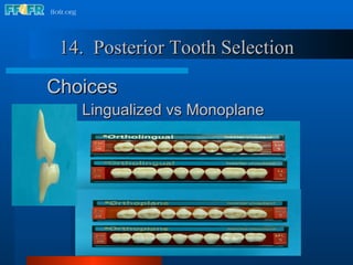 22.criteria for posterior tooth selection | PPT