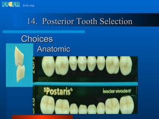 22.criteria for posterior tooth selection | PPT