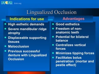 22.criteria for posterior tooth selection | PPT