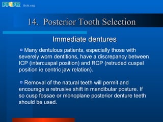 22.criteria for posterior tooth selection | PPT