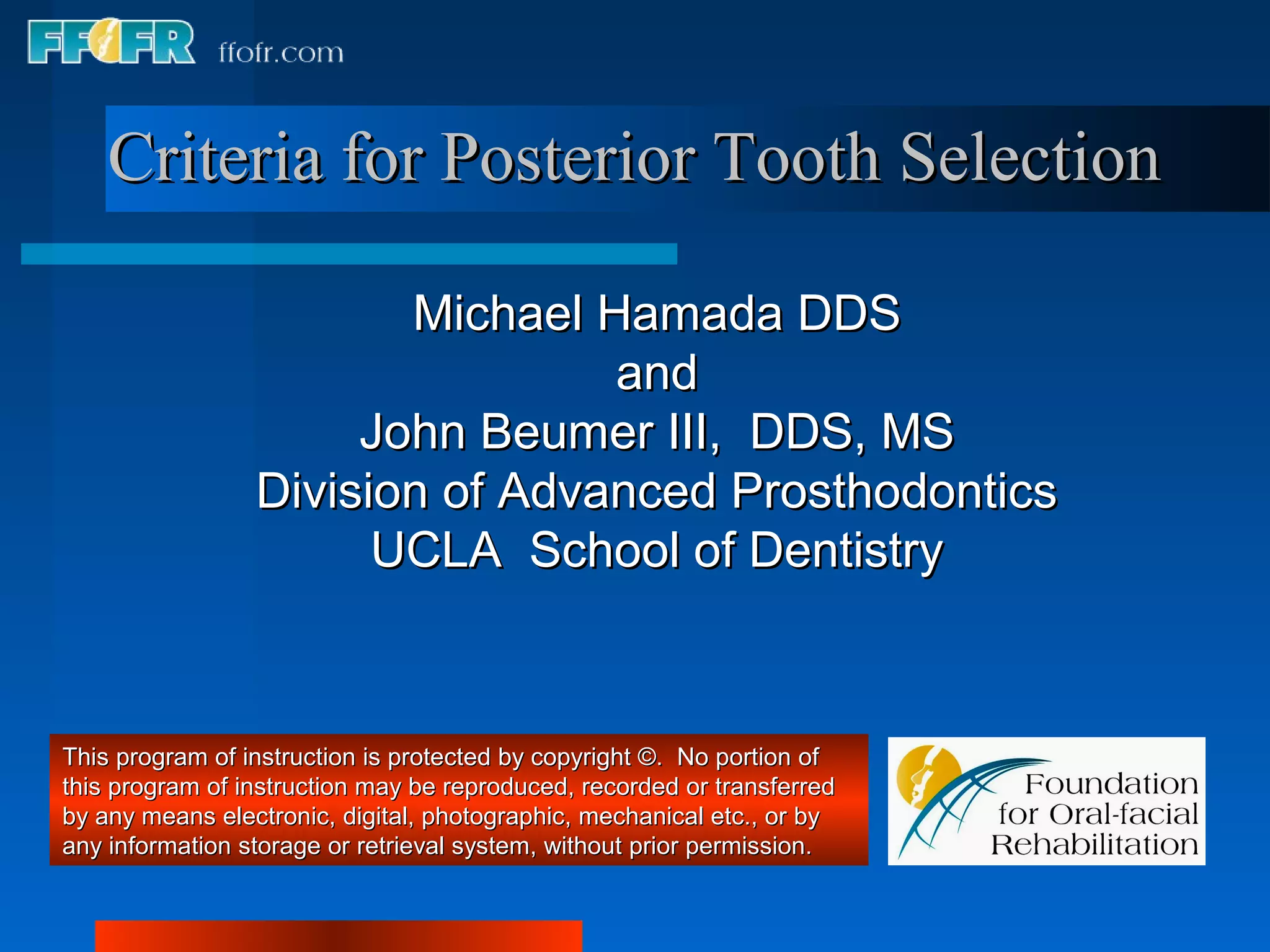 22.criteria for posterior tooth selection | PPT