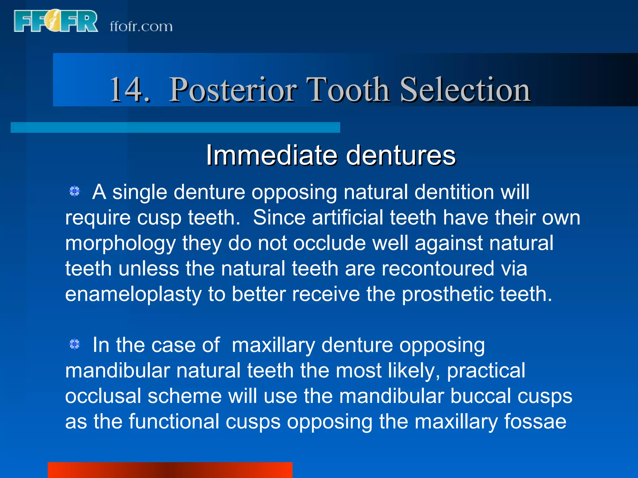 22.criteria for posterior tooth selection | PPT