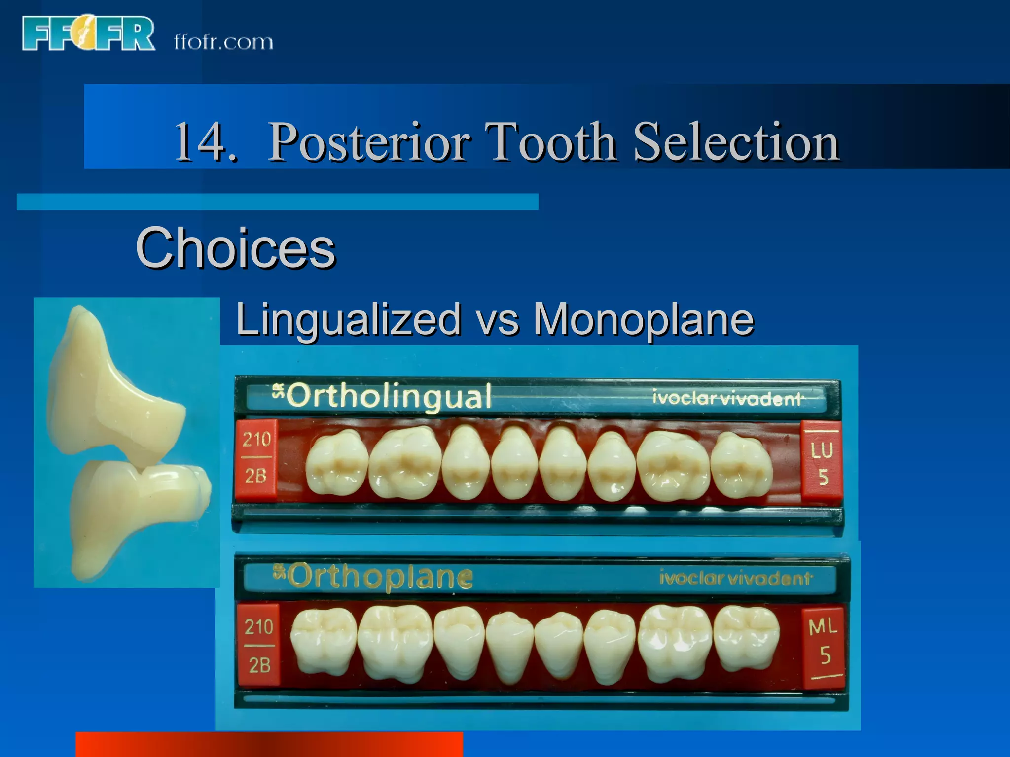 22.criteria for posterior tooth selection | PPT
