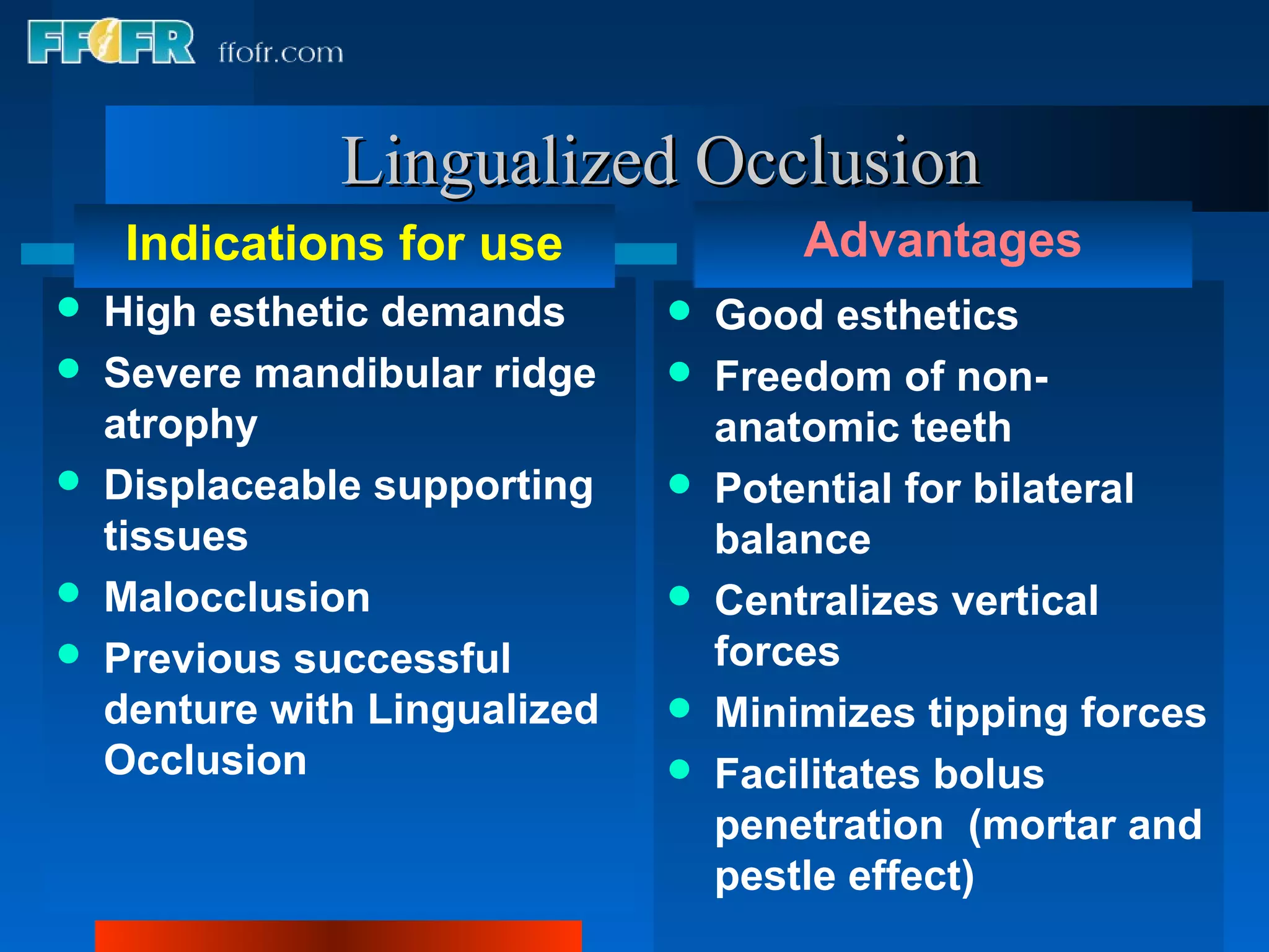 22.criteria for posterior tooth selection | PPT