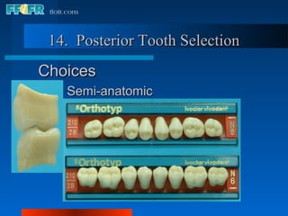 22.criteria for posterior tooth selection | PPT