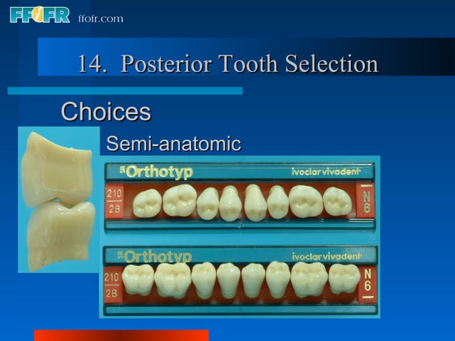 22.criteria for posterior tooth selection | PPT