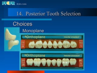 22.criteria for posterior tooth selection | PPT