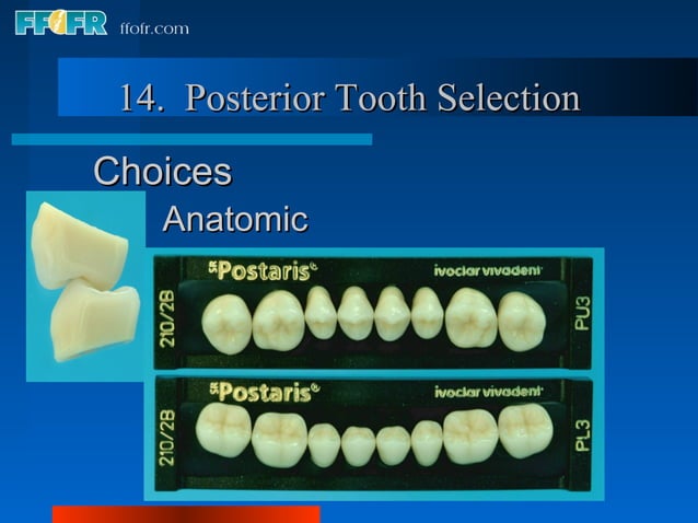 22.criteria for posterior tooth selection | PPT