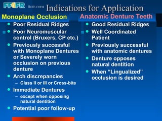 22.criteria for posterior tooth selection | PPT