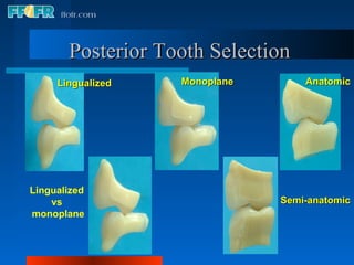 22.criteria for posterior tooth selection | PPT