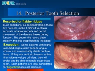 22.criteria for posterior tooth selection | PPT