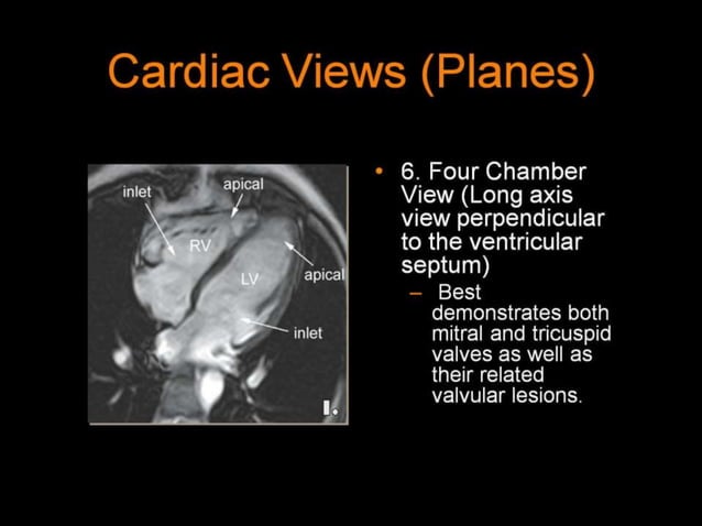 22 Dr Ahmed Esawy imaging oral board of cardaic CT MRI imaging | PPT