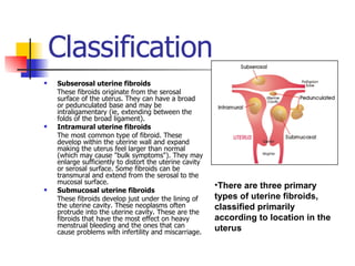 22.Leiomyoma Of The Uterus | PPT