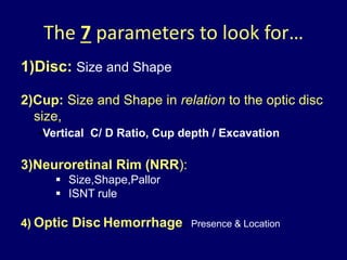 22 optic-disc-evaluation-in-glaucoma | PPT