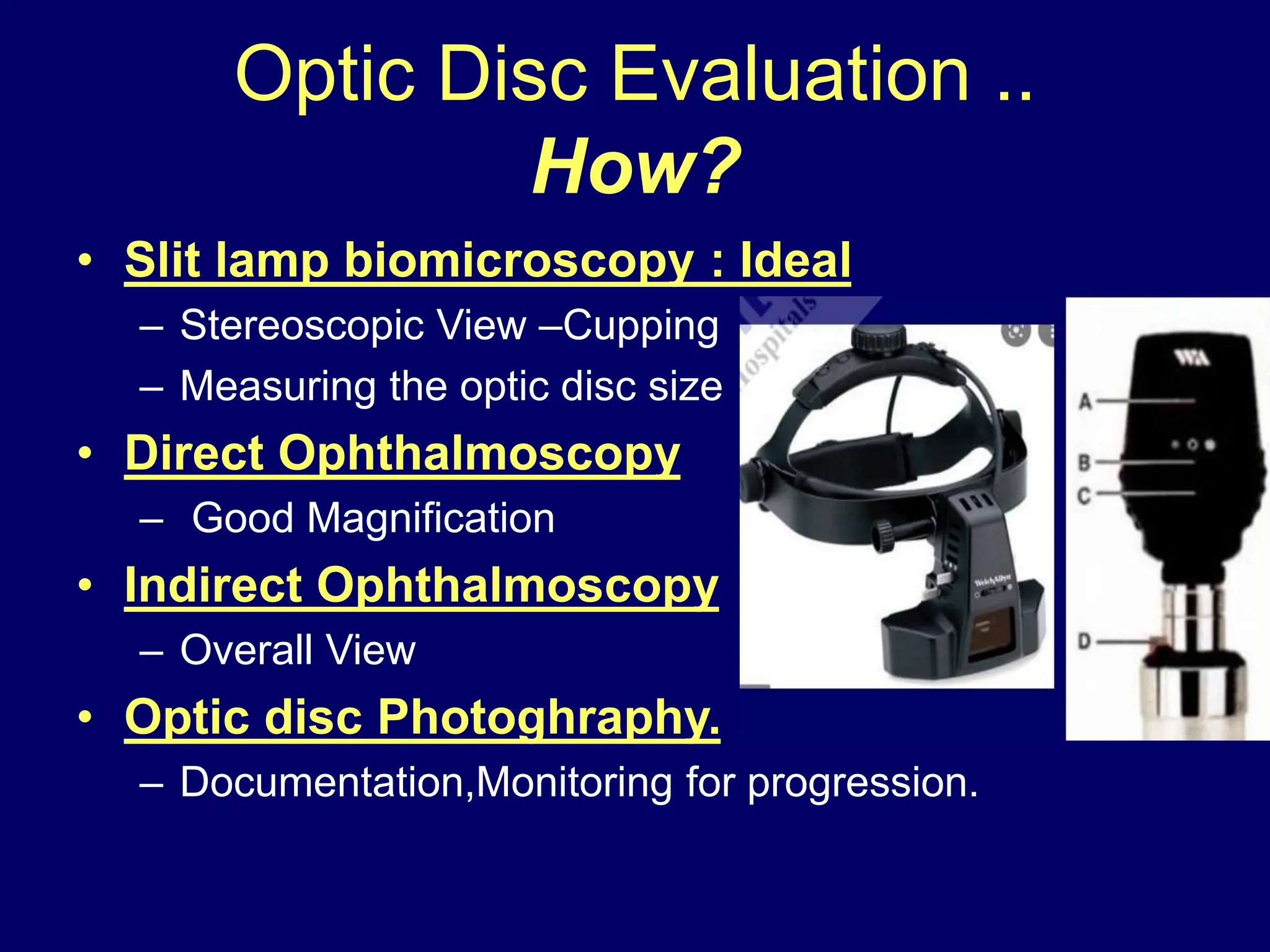 22-Optic-Disc-Evaluation-IN-Glaucoma.ppt