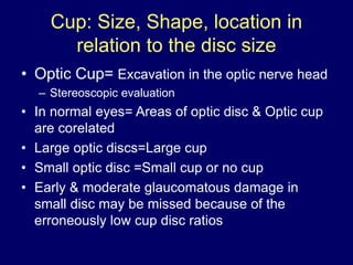 22-Optic-Disc-Evaluation-IN-Glaucoma.ppt