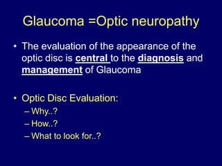 22-Optic-Disc-Evaluation-IN-Glaucoma.ppt