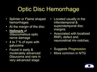 22-Optic-Disc-Evaluation-IN-Glaucoma.ppt