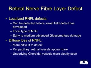 22-Optic-Disc-Evaluation-IN-Glaucoma.ppt