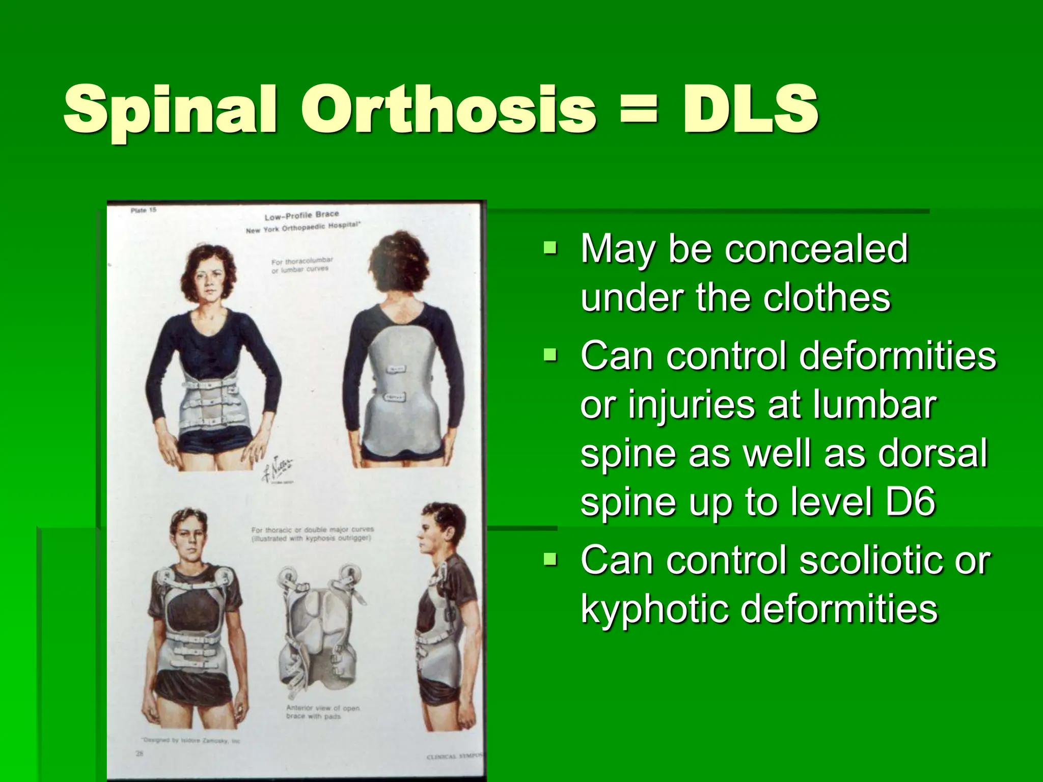 Orthotics & Prosthetics in Rehabilitation | PPT