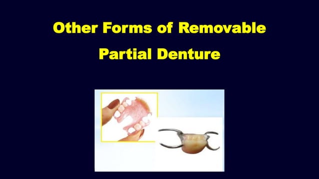 22- OTHER FORMS OF REMOVABLE PARTIAL DENTURE.pptx