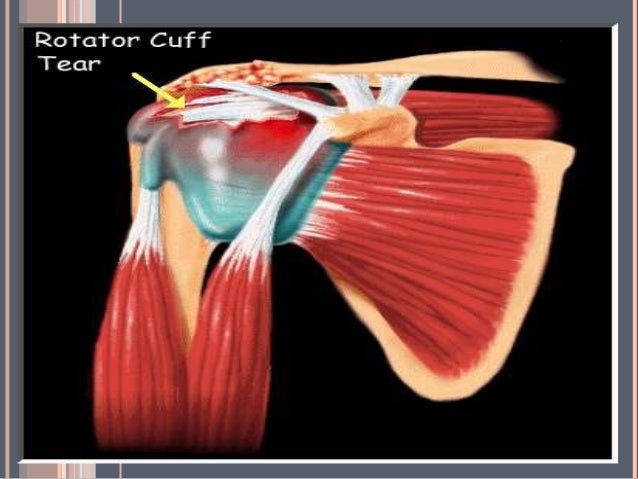 Shoulder Joint shoulder-joint