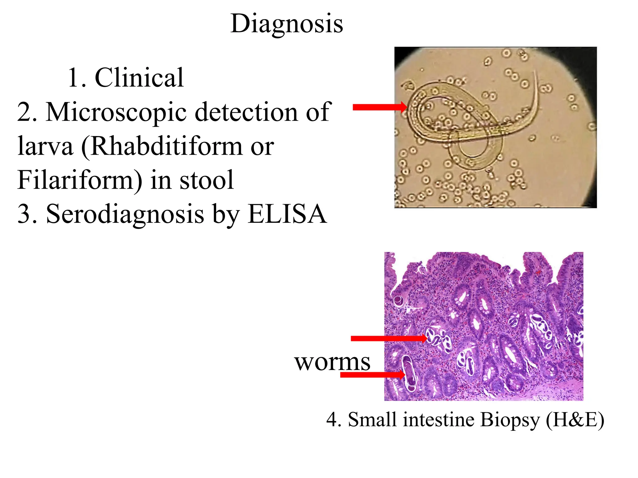 22-Strongyloides presentation in microbiology | PPTX