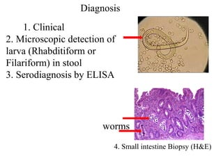 22-Strongyloides presentation in microbiology | PPTX