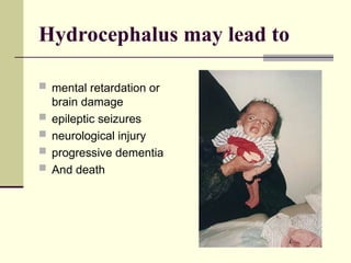 Hydrocephalus and it's types in children | PPT
