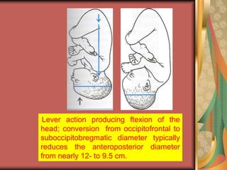 Mechanism of labour | PPT