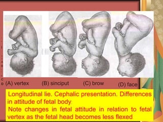 Mechanism of labour | PPT