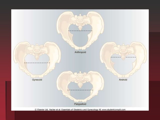 Plevic and fetal skull persented by nursing student for classes ...