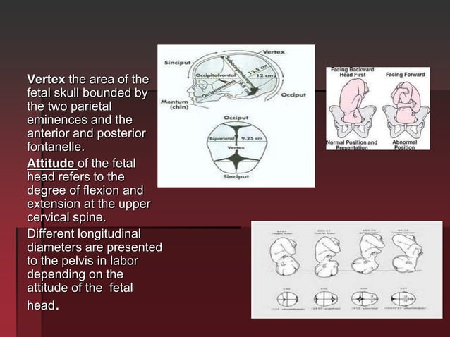 Plevic and fetal skull persented by nursing student for classes ...