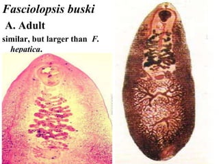 Fasciolopsis Buski Worm