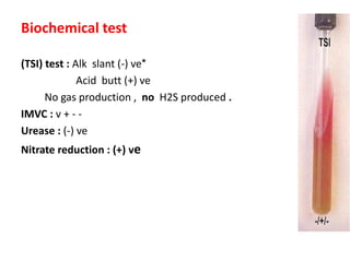 2_2019_03_22!10_34_54_PM shigellosis.pptx