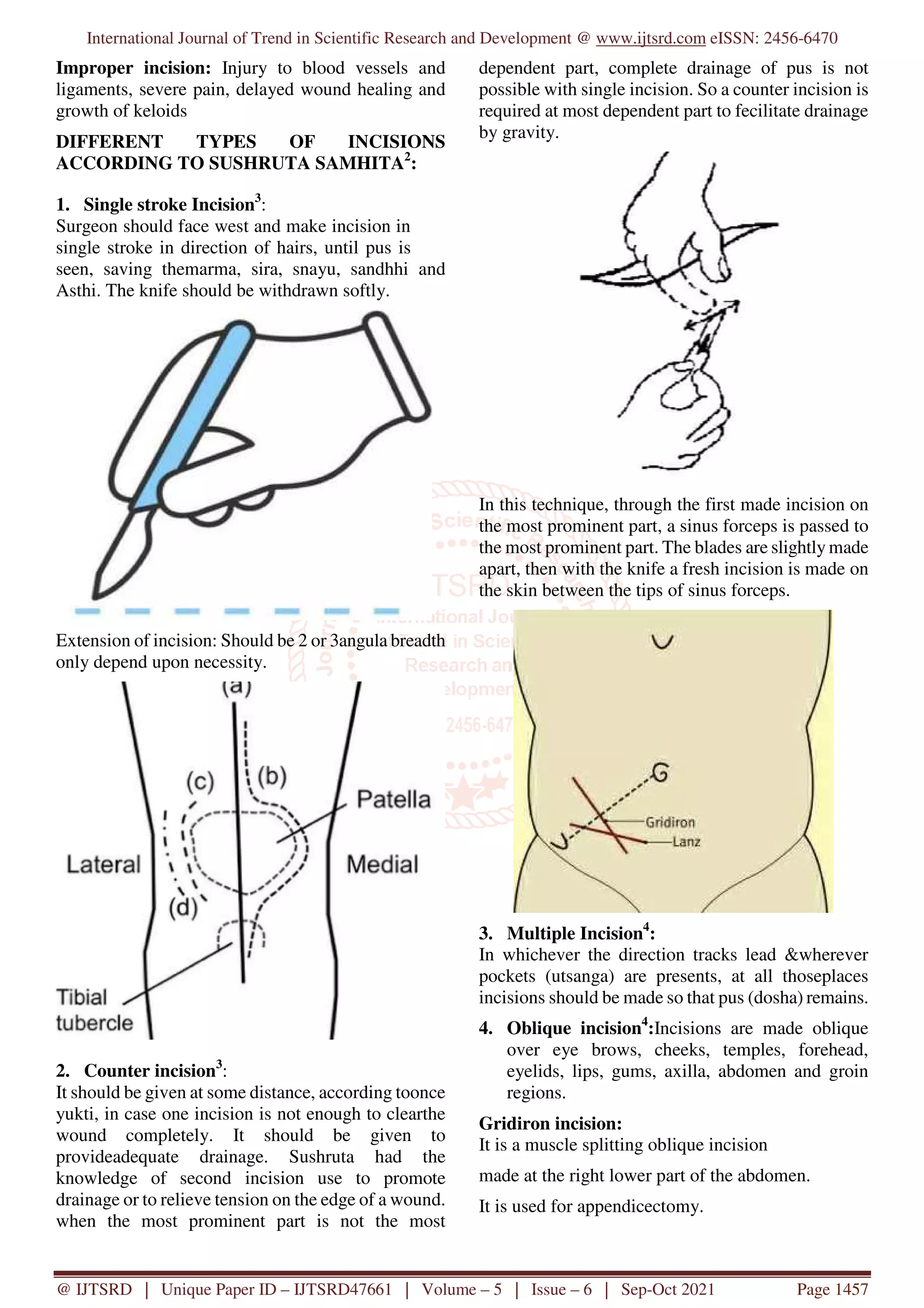 A Review Article on Different Types of Incisions According to Sushruta ...