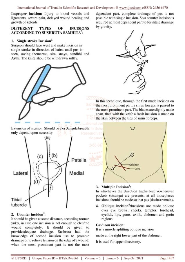 A Review Article on Different Types of Incisions According to Sushruta