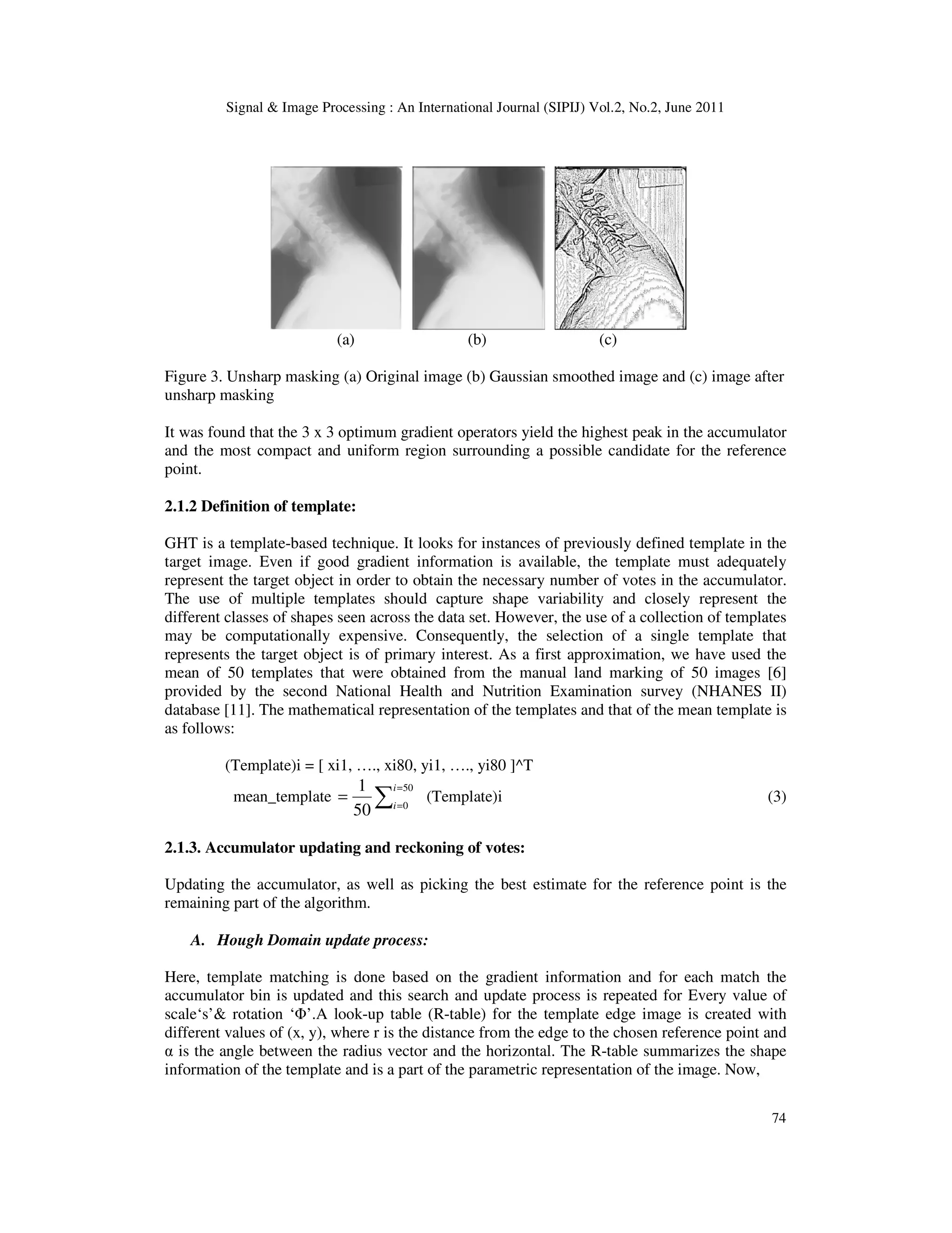 Anterior Osteophyte Identification in Cervical Vertebrae | PDF
