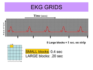 Ekgppt | PPT