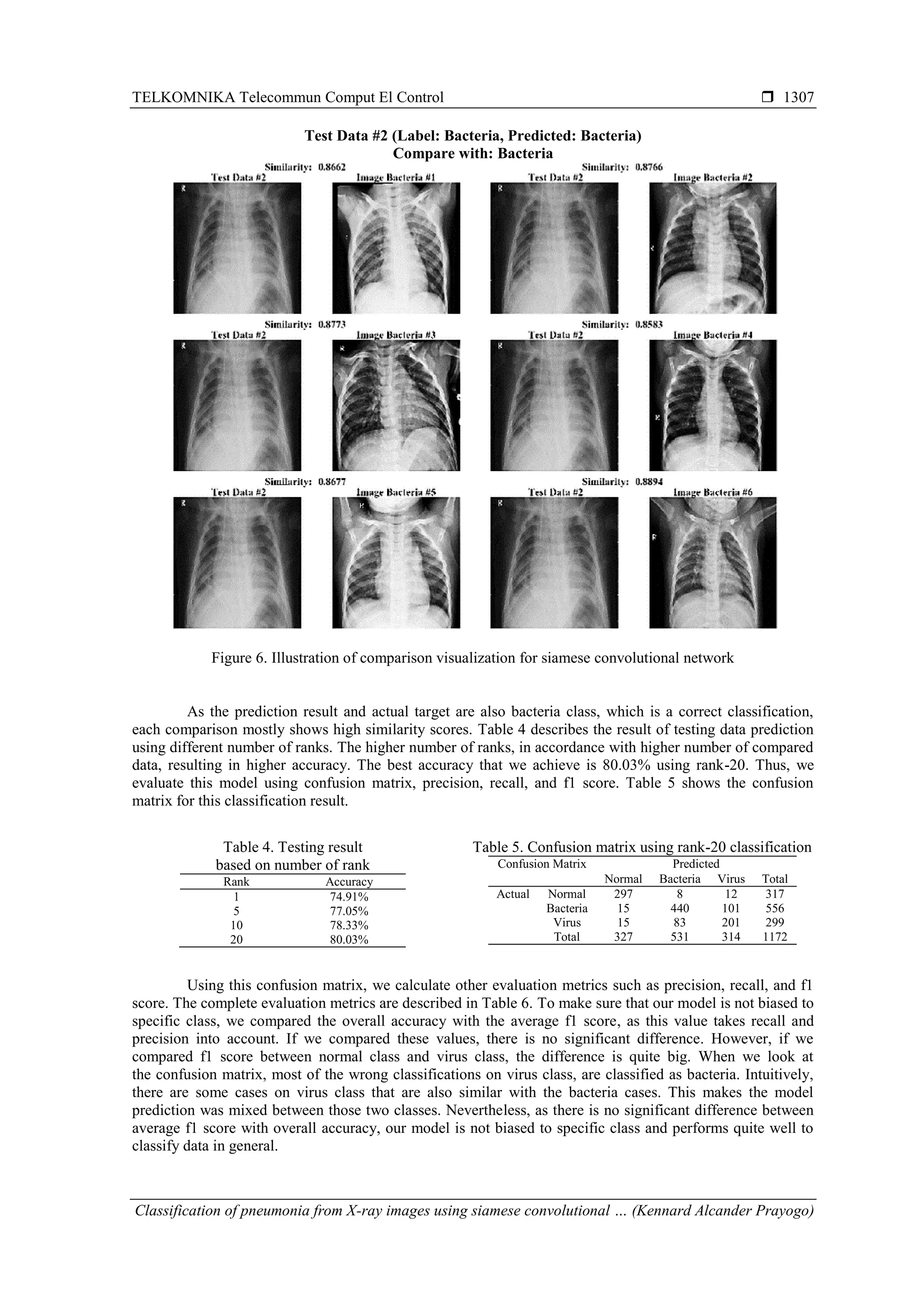 Classification of pneumonia from X-ray images using siamese ...