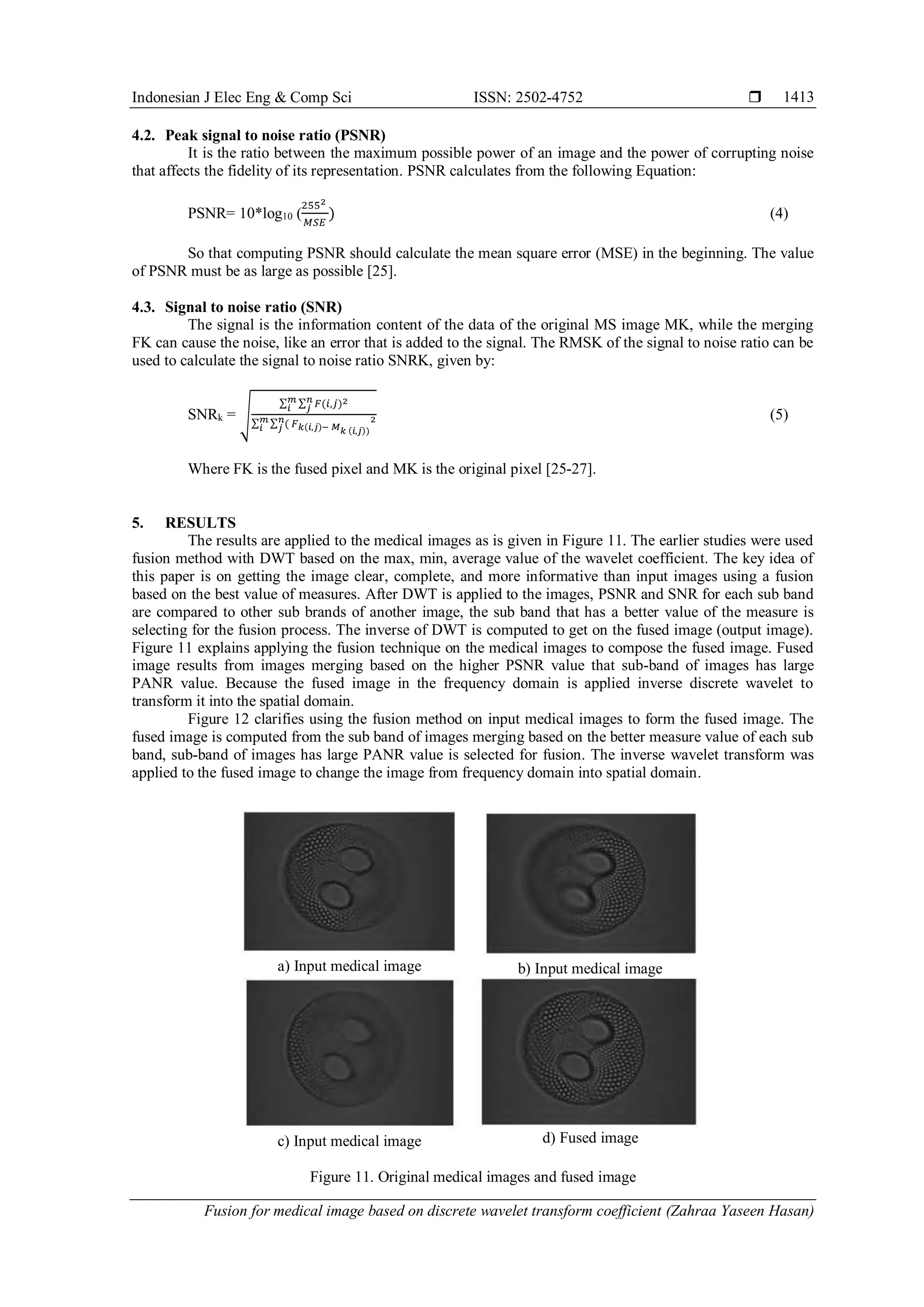 Fusion for medical image based on discrete wavelet transform coefficient | PDF