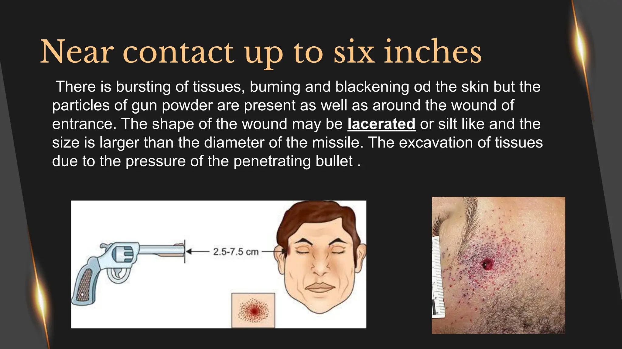 Forensic BALLISTICS # Identification of range of fire through wound ...