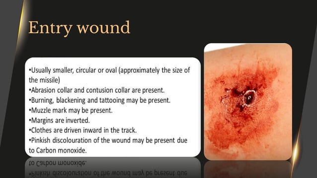 Forensic BALLISTICS # Identification of range of fire through wound ballistic | PDF